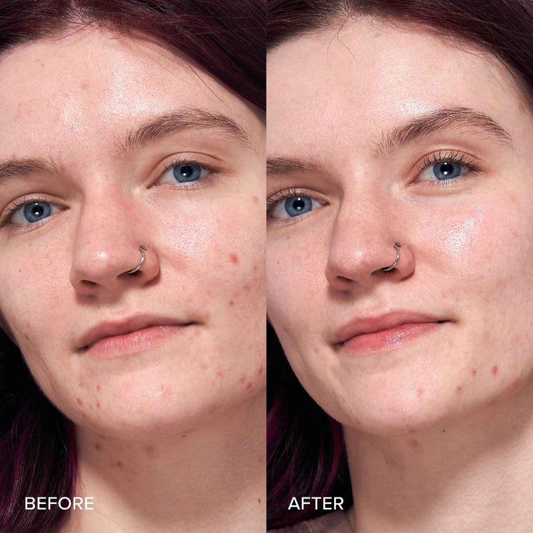 Allure Award Winning Pore Perfecting Face Toner For Minimizing Pores ...